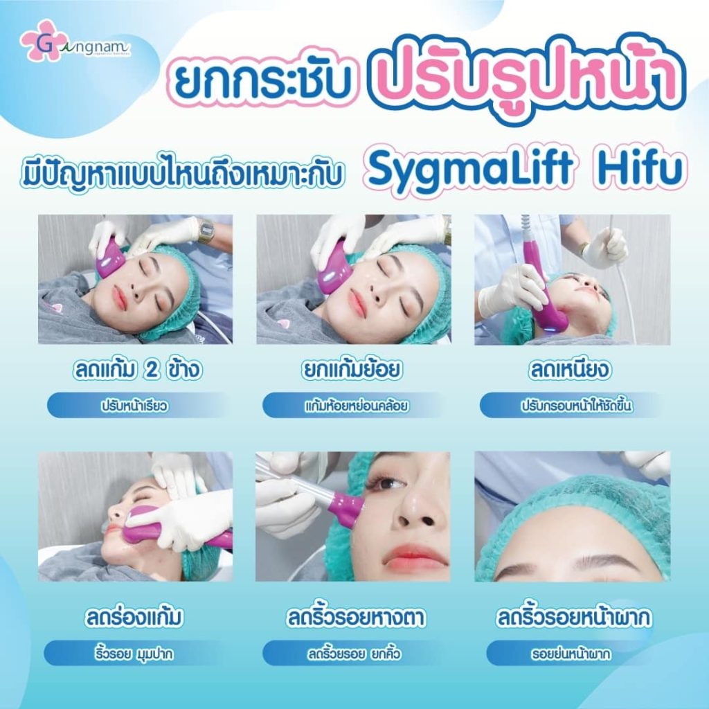 ยกกระชับหน้า Sygmalift Hifu ปรับรูปหน้าเรียว ไม่ต้องผ่าตัด - Gangnam Clinic