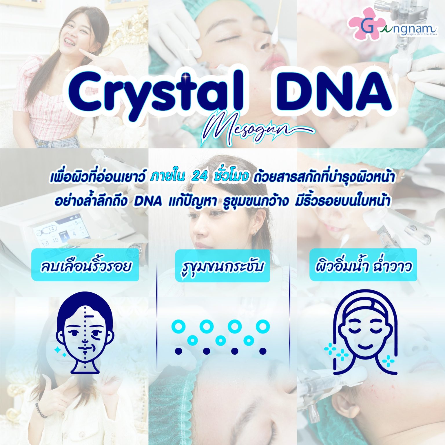 Crystal DNA คืออะไร? ช่วยฟื้นฟูผิวเรื่องอะไร ใครบ้างควรทำ? - Gangnam Clinic