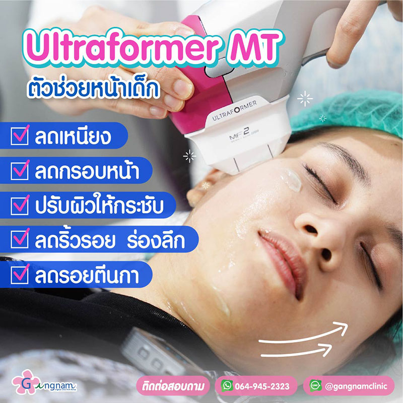 Ultraformer MPT ยกกระชับหน้า ปรับรูปร่าง ให้ผิวกระชับเต่งตึงขึ้น ...