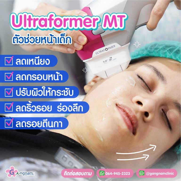 Ultraformer MPT ยกกระชับหน้า ปรับรูปร่าง ให้ผิวกระชับเต่งตึงขึ้น - Gangnam Clinic