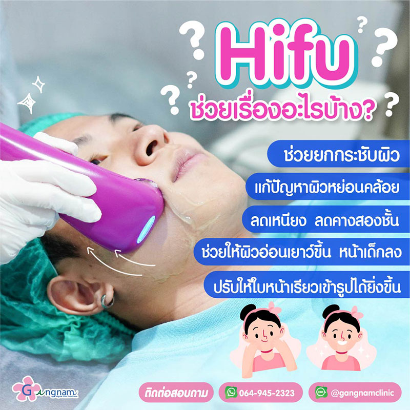 10 ข้อควรรู้ก่อนทำ Hifu คืออะไร? มีกี่แบบ? เลือกยี่ห้อไหนดี ให้เหมาะกับ ...