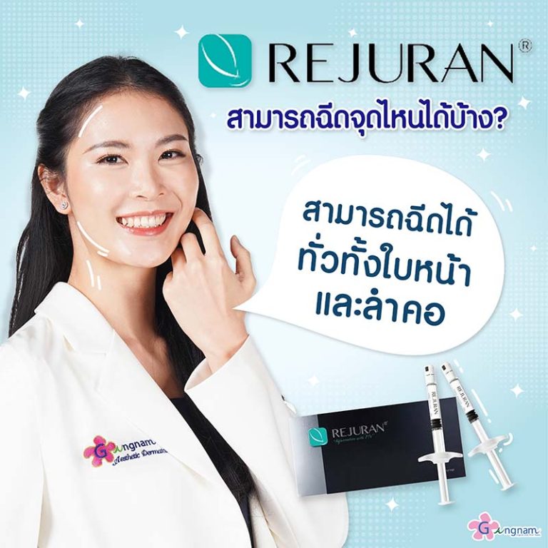 Rejuran คืออะไร? ข้อดี ข้อเสีย ต่างจากเมโสตัวอื่นอย่างไร อยู่ได้นานแค่ไหน