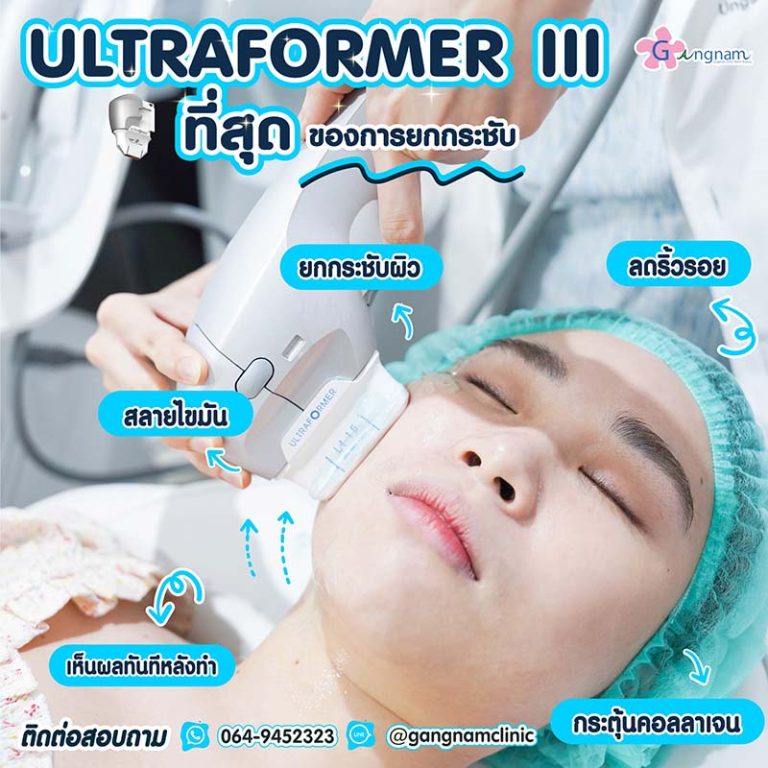 Ultraformer III คืออะไร? ช่วยเรื่องอะไรบ้าง ทำแล้วเห็นผลจริงไหม ...