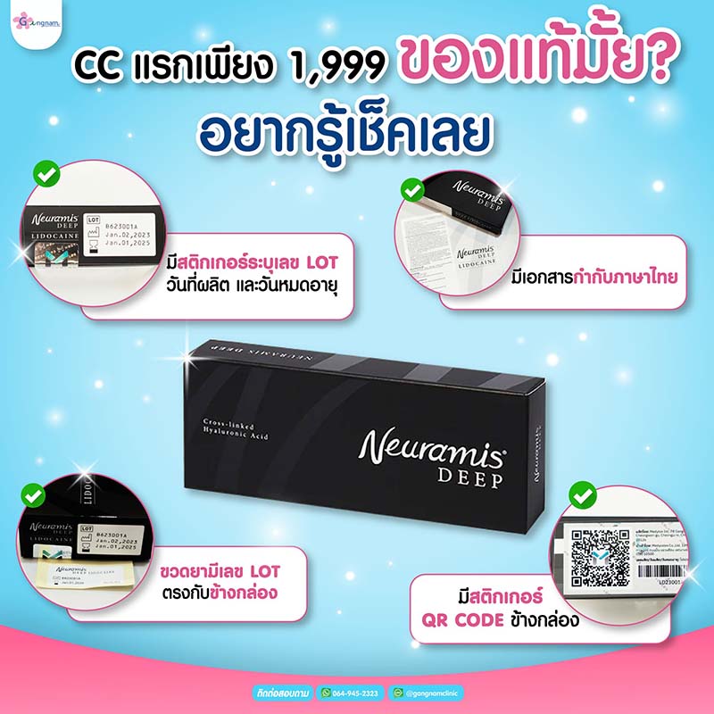 รู้จัก ฟิลเลอร์ Neuramis ดีไหม? มีกี่แบบ เหมาะกับฉีดตำแหน่งไหน ...