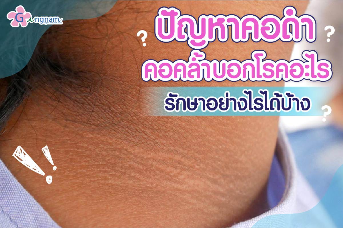 ปัญหาคอดำ คอคล้ำบอกโรคอะไร รักษาอย่างไรได้บ้าง - Gangnam Clinic