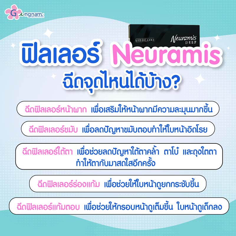 รู้จัก ฟิลเลอร์ Neuramis ดีไหม? มีกี่แบบ เหมาะกับฉีดตำแหน่งไหน ...