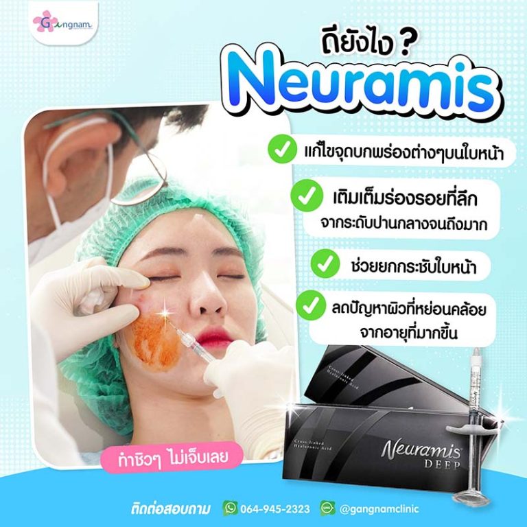 รู้จัก ฟิลเลอร์ Neuramis ดีไหม? มีกี่แบบ เหมาะกับฉีดตำแหน่งไหน? - Gangnam Clinic