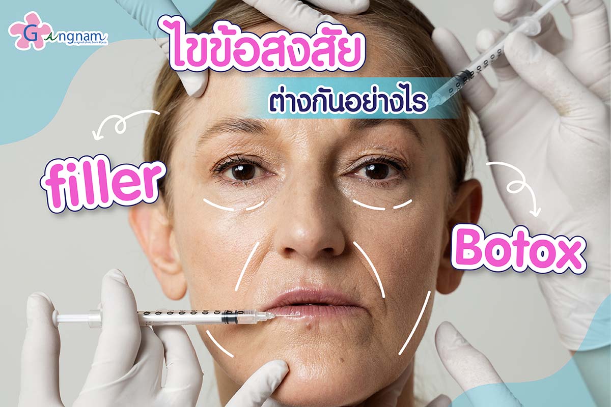 เปรียบเทียบ Filler กับ Botox ต่างกันอย่างไร? เลือกฉีดอะไรก่อนดี ...