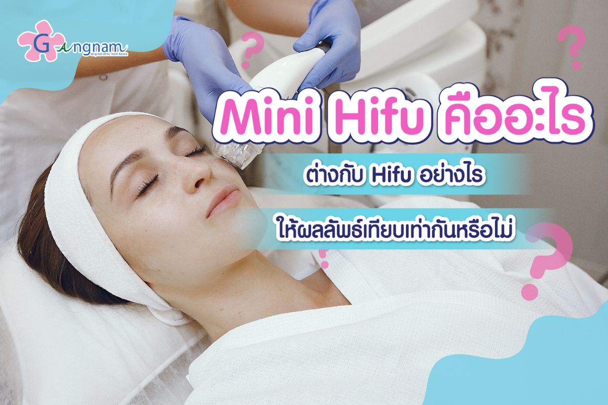 มินิ ไฮฟู่ Mini Hifu คืออะไร ได้ผลจริงไหม? ทำกี่วันถึงเห็นผล