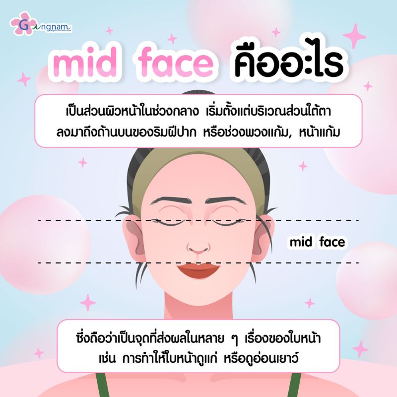 mid face คืออะไร ฉีดฟิลเลอร์แล้วช่วยให้หน้าเด็กได้จริงไหม