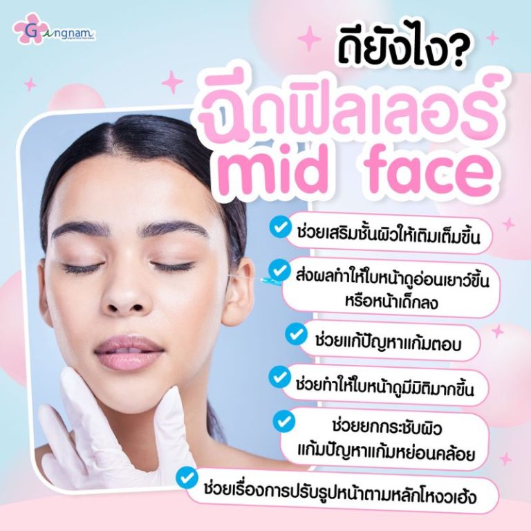 mid face คืออะไร ฉีดฟิลเลอร์แล้วช่วยให้หน้าเด็กได้จริงไหม