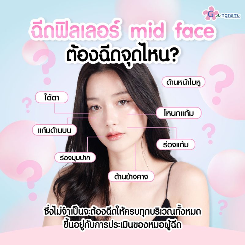 mid face คืออะไร ฉีดฟิลเลอร์แล้วช่วยให้หน้าเด็กได้จริงไหม
